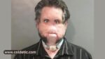 Ugliest Person in the World of 2024: List of Person - coldetic